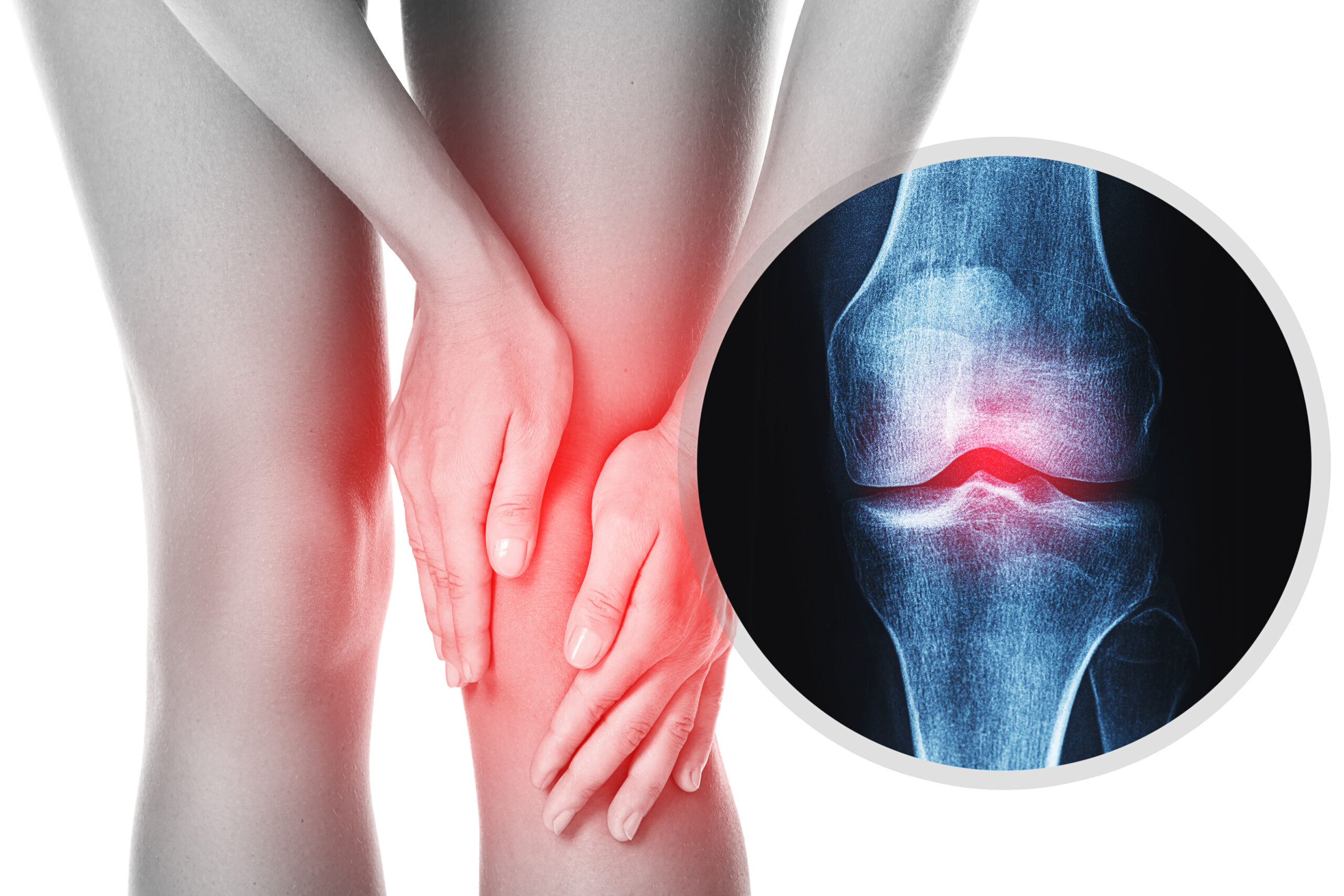 What is osteoarthritis? Symptoms and Prevention - Blue Heron Health Care